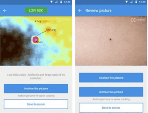 SkinVision track and monitor app for melanoma launched in New Zealand ...