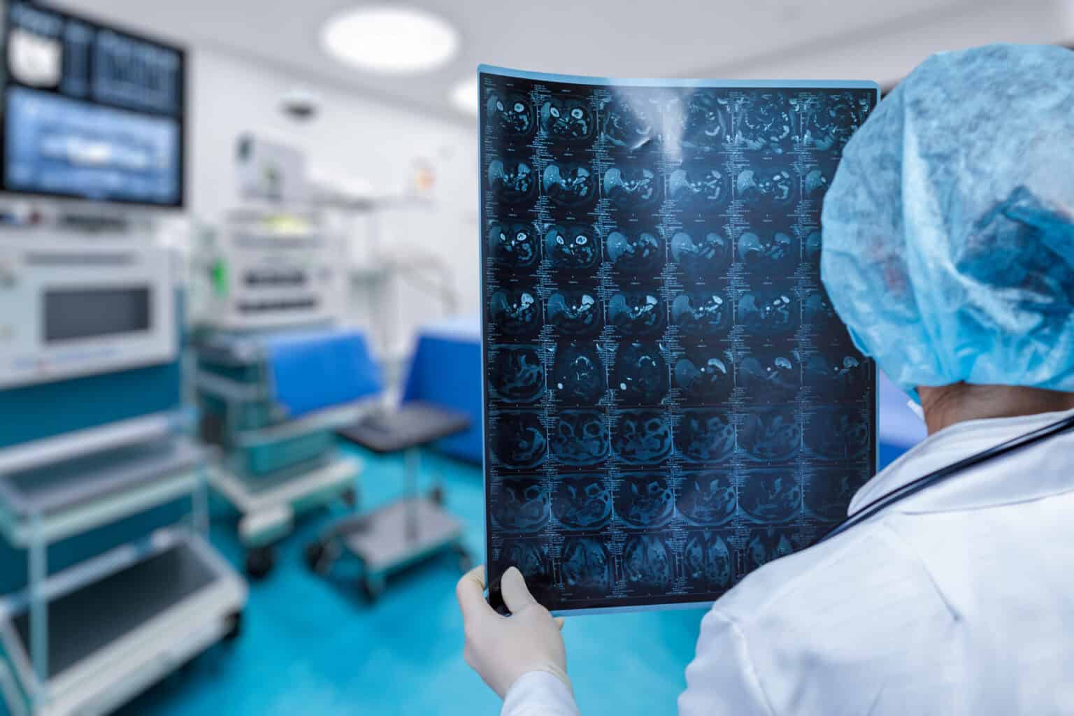 Digital detection and AI offer better breast cancer screening - Pulse+IT