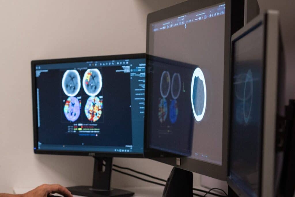 Nicolab partners with Health NZ on AI-powered stroke study - Pulse+IT