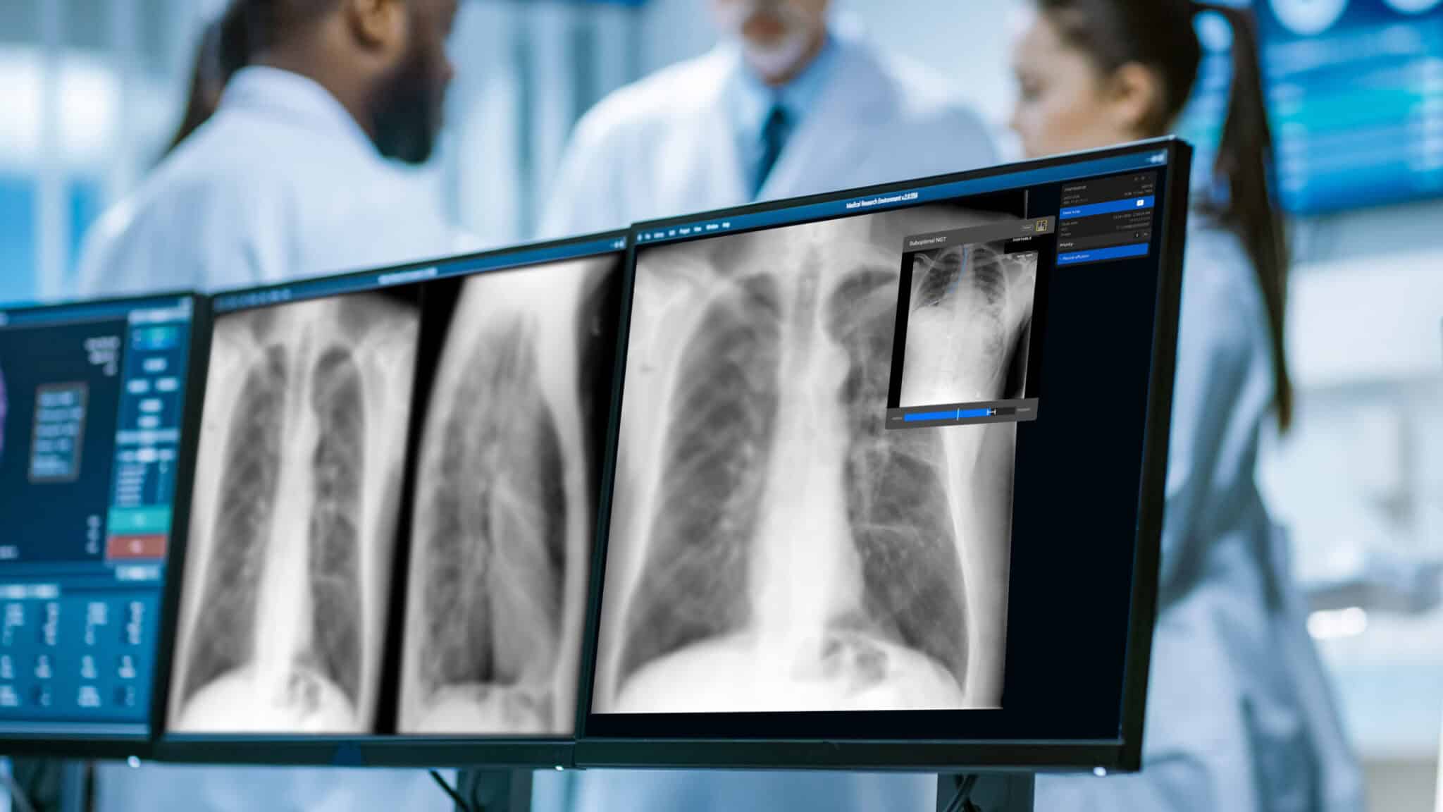 Harrison.ai rebrands radiology solution - Pulse+IT